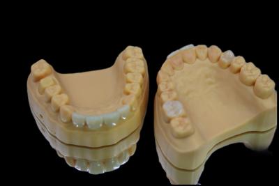 China Custom Porcelain Veneers 0.3mm Minimally Invasive Stain Resistant Dental Veneer for sale