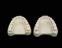 China Custom Porcelain Veneers Stain Resistance 0.3mm Dental Lab Outsourcing for sale