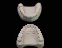 China Custom Anatomical Porcelain Veneers 0.3mm Ultra Thin Dental Veneers Stain Resistance for sale