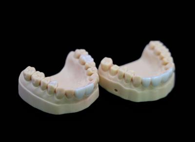 China Durable Flexible Dental Veneers 0.3mm Stain Resistant Porcelain Veneers for Minimally Invasive Smile Makeover for sale