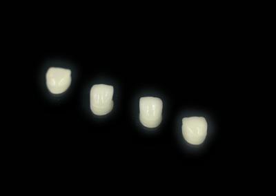 China Custom Porcelain Dental Veneers 0.3mm Ultra Thin Translucent Ceramic Veneer for Smile Restoration for sale