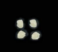 China Minimally Invasive Porcelain Veneer Teeth 0.3mm Custom Dental Crowns for sale