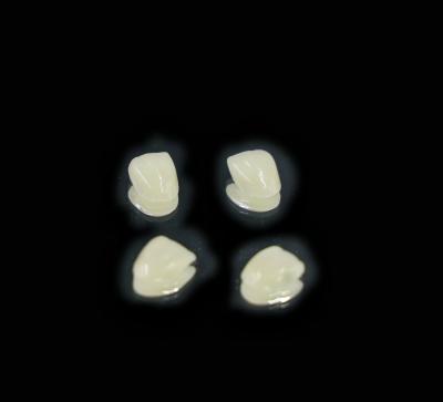 China Minimally Invasive Porcelain Veneer Teeth 0.3mm Custom Dental Crowns for sale
