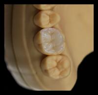 China China Dental Lab Emax Inlay Lithium Disilicate Heat Pressed 530 MPa Strength for sale