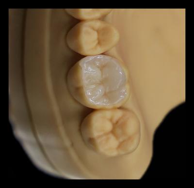 China China Dental Lab Emax Inlay Lithium Disilicate Heat Pressed 530 MPa Strength for sale