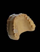 China China Dental Lab Emax Inlay Lithium Disilicate Heat Pressed 530 MPa Strength for sale