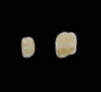 China Dental Laboratory Emax Inlay Lithium Disilicate 530 MPa Flexural Strength CE Certified for sale