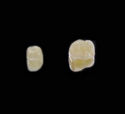 China Dental Laboratory Emax Inlay Lithium Disilicate 530 MPa Flexural Strength CE Certified for sale