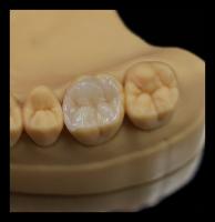China Dental Laboratory Emax Inlay Lithium Disilicate 530 MPa Flexural Strength CE Certified for sale