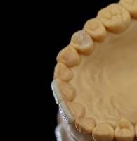 China China Dental Outsourcing Emax Inlay Lithium Disilicate CE Marked 470 MPa Flexural Strength for sale