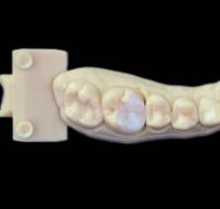China China Dental Outsourcing Emax Inlay Lithium Disilicate CE Marked 470 MPa Flexural Strength for sale