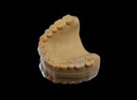 China Lithium Disilicate Emax Inlay Digital Dental Design Service 530 MPa for sale