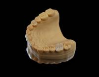China Lithium Disilicate Dental Emax Inlay 530 MPa Flexural Strength CE Marked for sale
