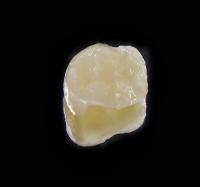 China Lithium Disilicate Dental Emax Inlay 530 MPa Flexural Strength CE Marked for sale