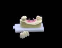 China Medical Grade Titanium Zirconia Dental Implant Abutments Universal Compatibility 30° Angled for sale