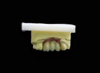 China Medical Grade Titanium Zirconia Dental Implant Abutments Universal Compatibility 30° Angled for sale
