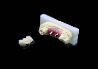 China Medical Grade Titanium Zirconia Dental Implant Abutments Digital Design Services for sale