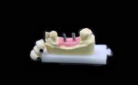 China Medical Grade Titanium Zirconia Dental Implant Abutments Digital Design Services for sale