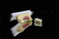 China Medical Grade Titanium Zirconia Dental Implant Abutments 4.5mm Platform for sale