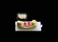 China Medical Grade Titanium Zirconia Dental Implant Abutments 4.5mm Platform for sale