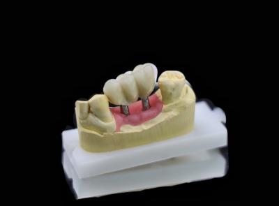 China Medical Grade Titanium Zirconia Dental Implant Abutment CNC Precision Universal Compatibility for sale