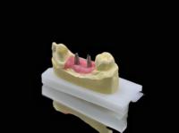 China Medical Grade Titanium Zirconia Dental Implant Abutment CNC Precision Universal Compatibility for sale