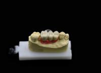 China Medical Grade Titanium Zirconia Dental Implant Abutments CNC Precision Universal Compatibility 4mm for sale