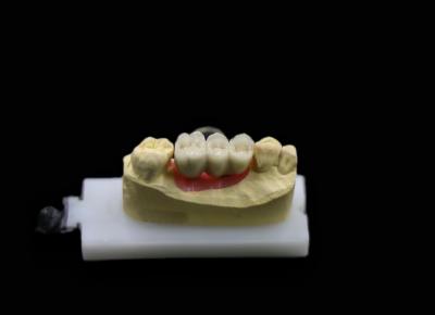 China Medical Grade Titanium Zirconia Dental Implant Abutments CNC Precision Universal Compatibility 4mm for sale