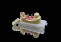 China Medical Grade Titanium Zirconia Dental Implant Abutments CNC Precision Universal Compatibility 4mm for sale