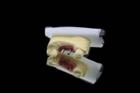China CNC Machined Zirconia Dental Implant Abutment Universal 4.8mm Compatible Straumann Nobel for sale