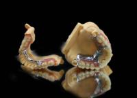 China Biocompatible CCP Dental Cobalt Chromium Alloy Metal Framework for Removable Partial Dentures for sale
