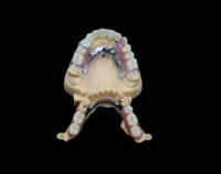 China Cobalt Chromium Alloy Dental Framework With Precision Digital Workflow for sale