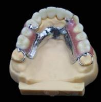 China Dental Laboratory Chrome Cobalt Cast Metal Framework 100mm Removable Partial Denture for sale