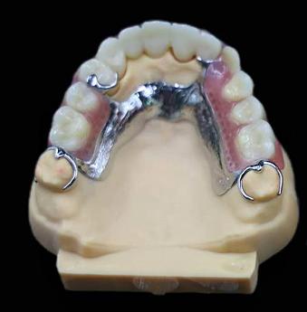 China Dental Laboratory Chrome Cobalt Cast Metal Framework 100mm Removable Partial Denture for sale