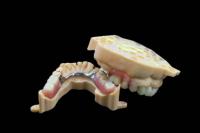China Hypoallergenic Cobalt-Chromium Dental Framework for Removable Partial Dentures 0.5mm for sale