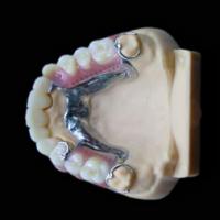 China Hypoallergenic Cobalt-Chromium Dental Framework for Removable Partial Dentures 0.5mm for sale