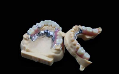 China Precision Digital CCP Dental Framework Cobalt Chromium Alloy Metal Framework for sale