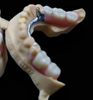 China Precision Digital CCP Dental Framework Cobalt Chromium Alloy Metal Framework for sale