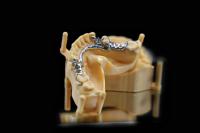 China 3D Printed Dental Metal Framework for Removable Partial Dentures CoCr Alloy 800 MPa for sale