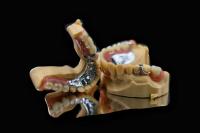 China 3D Printed Cobalt Chromium Partial Denture Framework 25-50 Micron Layer Thickness for sale