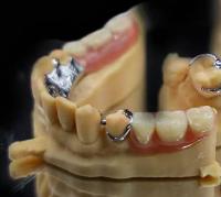 China Cobalt Chromium Alloy CCP Framework Dental Lab Polished Surface for sale