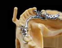 China Cobalt Chromium Alloy CCP Framework Dental Lab Polished Surface for sale
