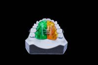 China Pre Prosthetic Maxillary Expander Hyrax Cobalt Chromium Alloy 0.20-0.25mm Expansion for sale