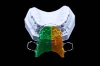 China Pre Prosthetic Maxillary Expander Hyrax Cobalt Chromium Alloy 0.20-0.25mm Expansion for sale