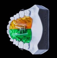 China Rapid Expansion Maxillary Expander Hyrax Tooth Borne Design for sale