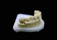 China China Dental Lab Porcelain-Fused-to-Metal (PFM) Crowns for sale