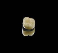 China China Dental Lab Porcelain-Fused-to-Metal (PFM) Crowns for sale