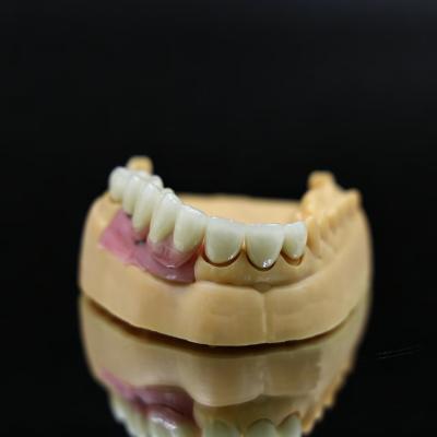 China China Outsourcing Dental Lab Porcelain-Fused-to-Metal (PFM) Crowns for sale