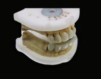 China Premium Quality Dental Product Porcelain-Fused-to-Metal (PFM) Crowns for sale