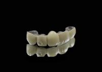 China Premium Quality Dental Product Porcelain-Fused-to-Metal (PFM) Crowns for sale